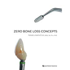 Zero Bone Loss Concepts by Linkevicius, Tomas (9780867157994)